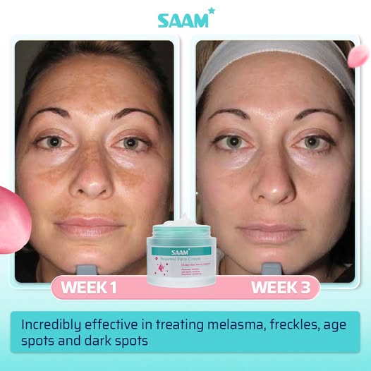 ORIGINAL Saam Renewal Face Cream – Starsam Naturals