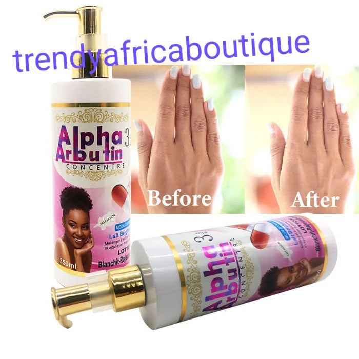 GLUTA-MAGIC ACID Alpha Arbutin 3 PLUS Body Lotion. – Starsam Naturals